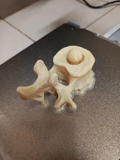 Articulating Lumbar Vertebrae Spine Remixed by GSam85 MakerWorld ...