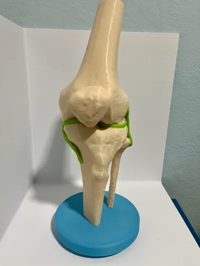 Anatomical Knee Model (from real CT) - Free 3D Print Model - MakerWorld