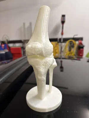 Anatomical Knee Model (from real CT) by TreeD-prints MakerWorld ...