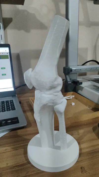 Anatomical Knee Model (from real CT) - Free 3D Print Model - MakerWorld