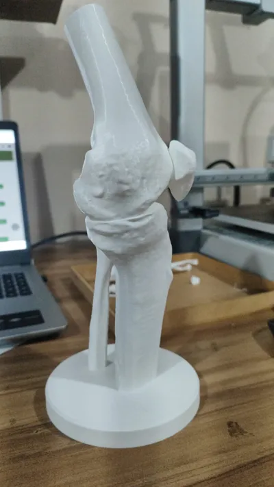 Anatomical Knee Model (from real CT) - Free 3D Print Model - MakerWorld