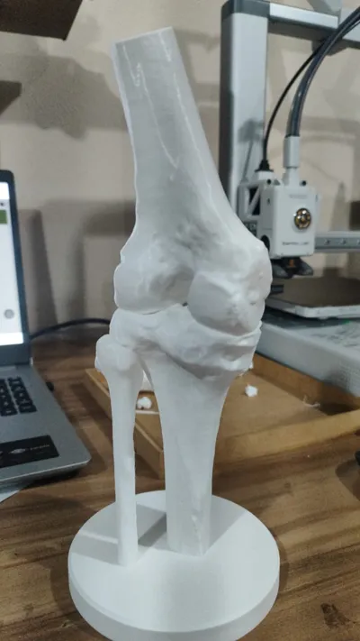 Anatomical Knee Model (from real CT) - Free 3D Print Model - MakerWorld