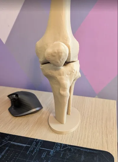 Anatomical Knee Model (from real CT) by TreeD-prints MakerWorld ...