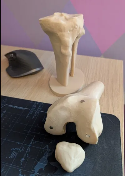 Anatomical Knee Model (from real CT) by TreeD-prints MakerWorld ...