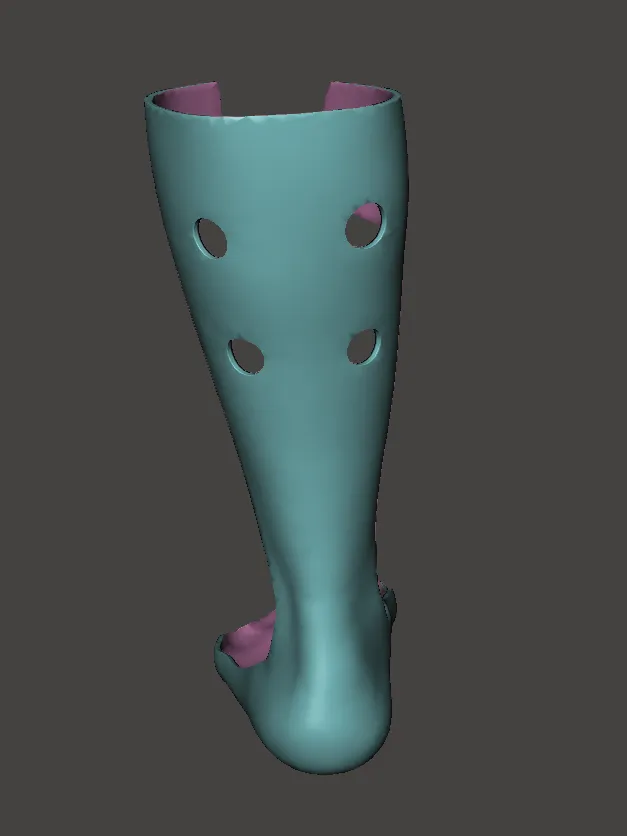 AFO - ANKLE FOOT ORTHOSIS - Free 3D Print Model - MakerWorld