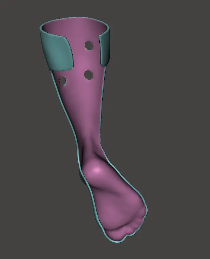 AFO - ANKLE FOOT ORTHOSIS - Free 3D Print Model - MakerWorld