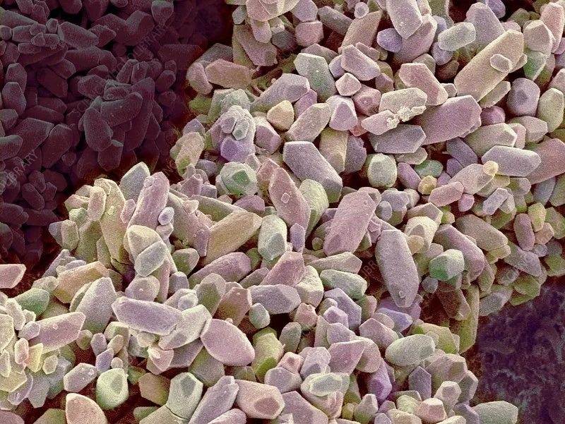 Inner ear crystals (otoconia/otolith) by Vestibular First MakerWorld ...