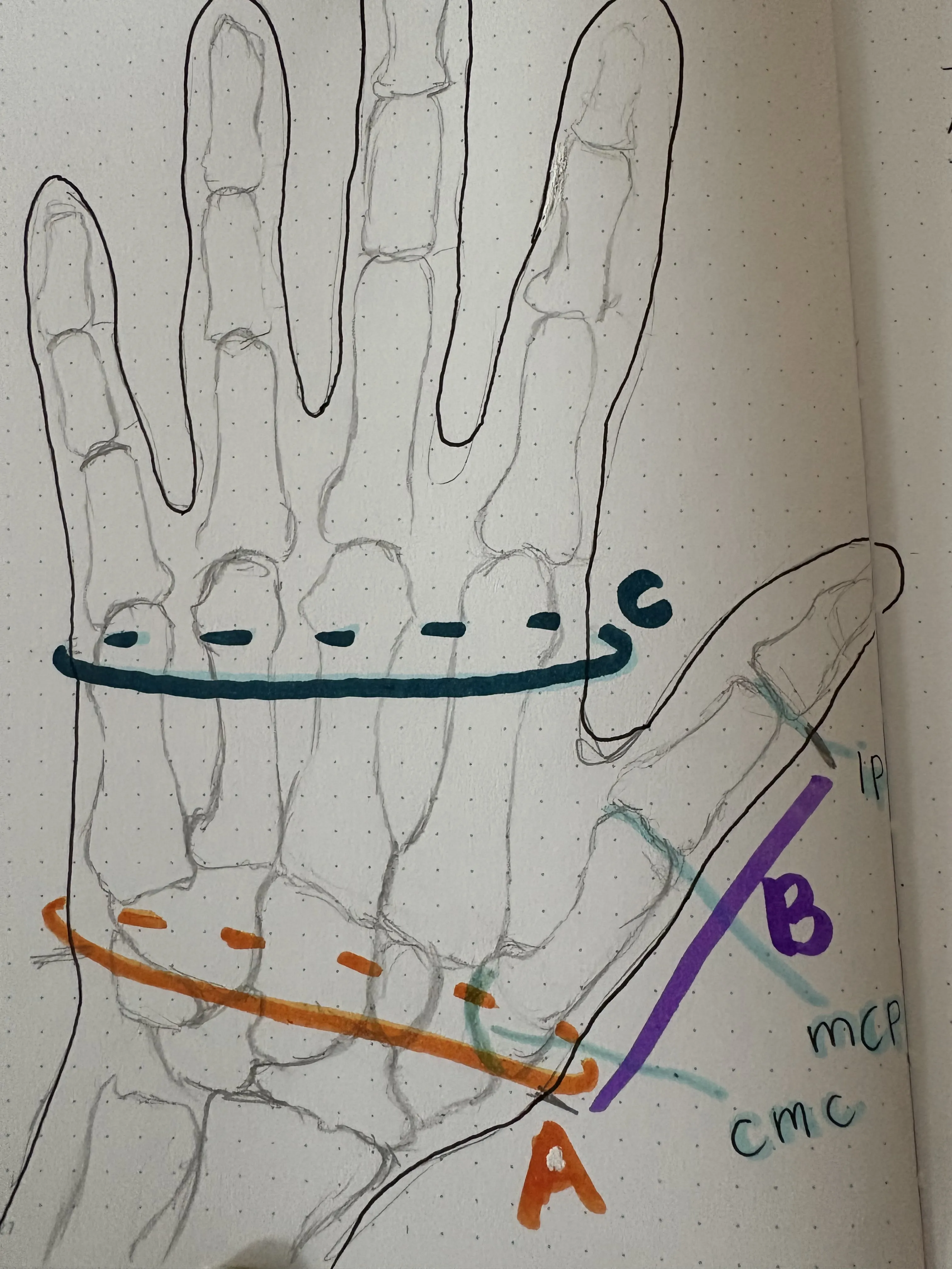 Right Thumb Brace CMC+MCP by familieKP MakerWorld: Download Free 3D Models