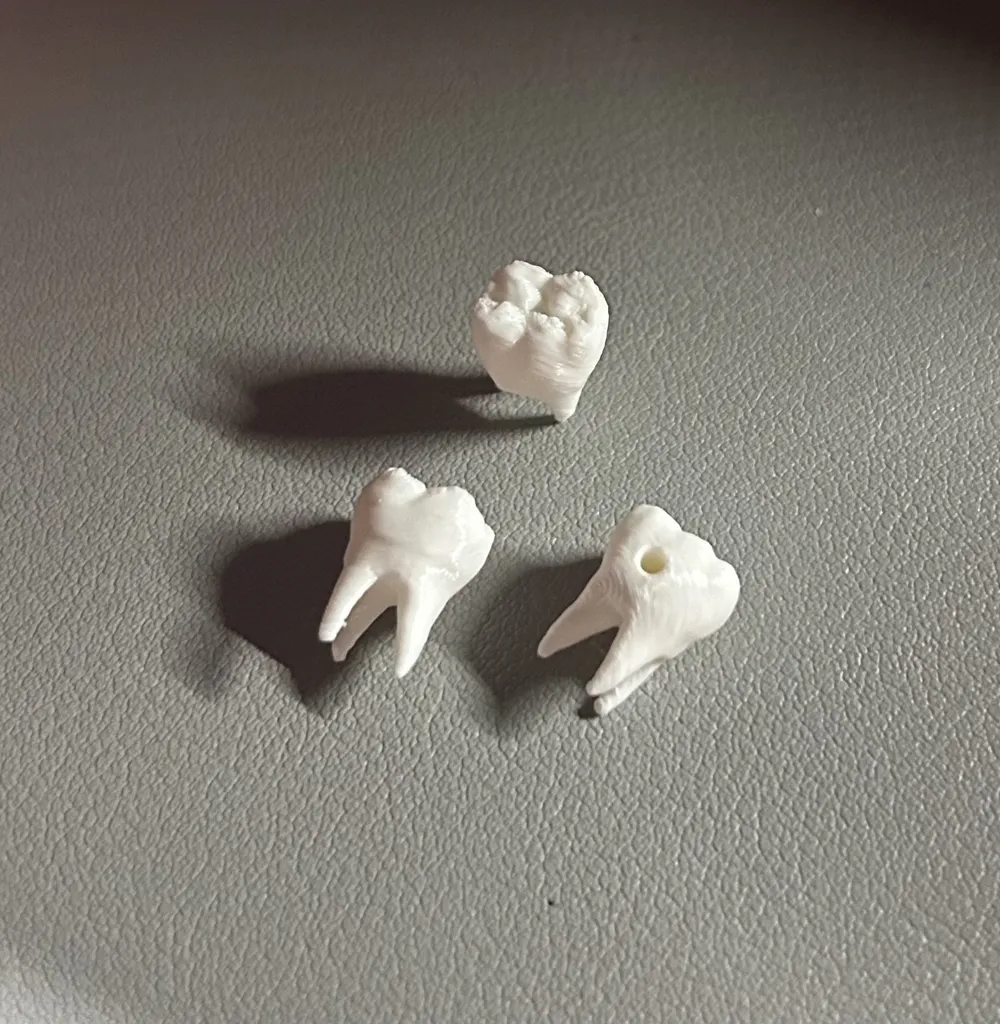 Realistic Tooth Molar - Free 3D Print Model - MakerWorld