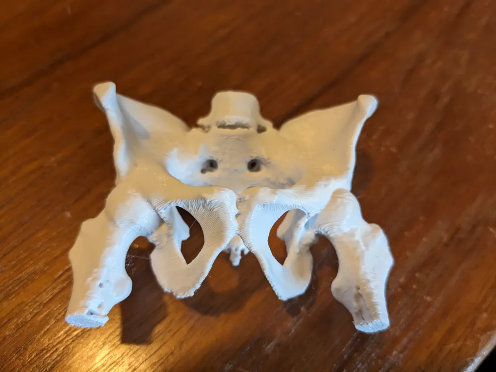 Real human pelvis - from CT scan by Robin Wilson - MakerWorld