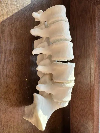 Lumbar Spine - Real Patient 3D Model by Arthrex MakerWorld: Download ...