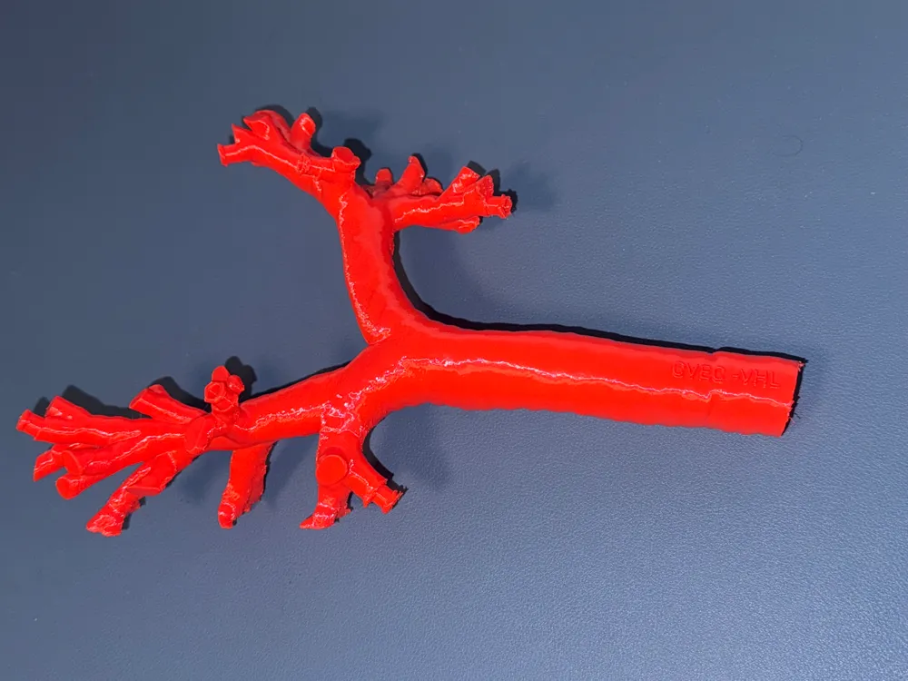 Bleeding Bronchoscopy Model Remixed by GSam85 - MakerWorld