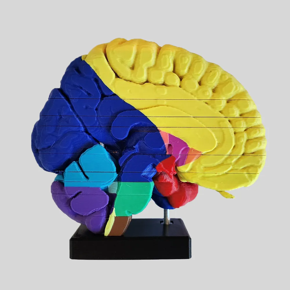 Cerebral Vascular Territories Model by Dan Man MD - MakerWorld