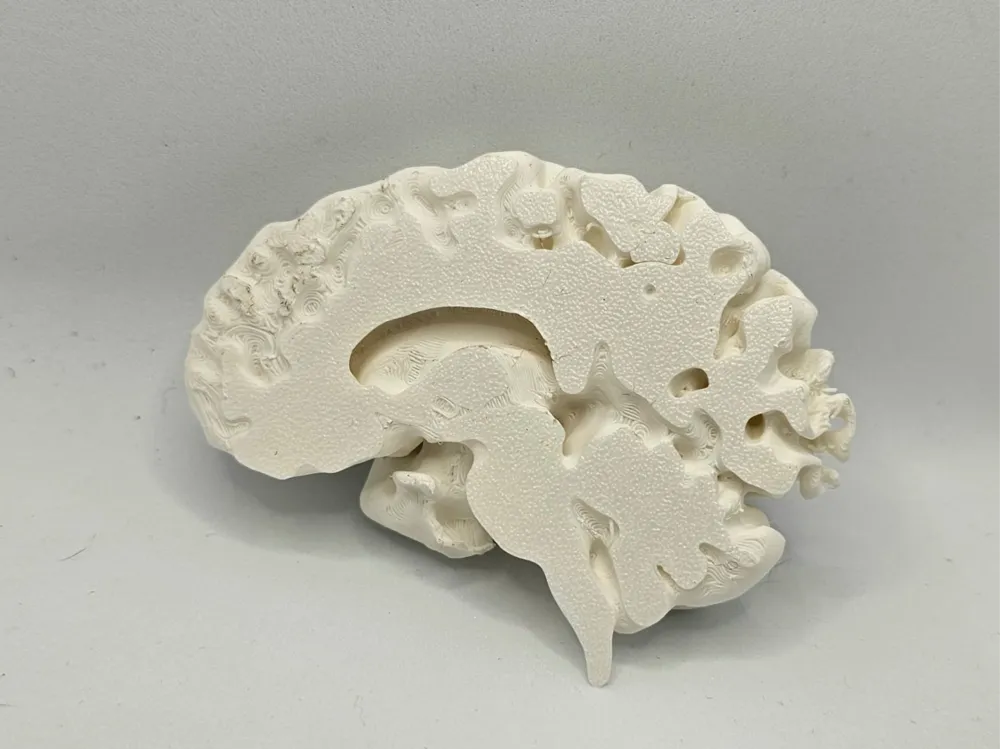 Brain Right Hemisphere (MRI) - Free 3D Print Model - MakerWorld