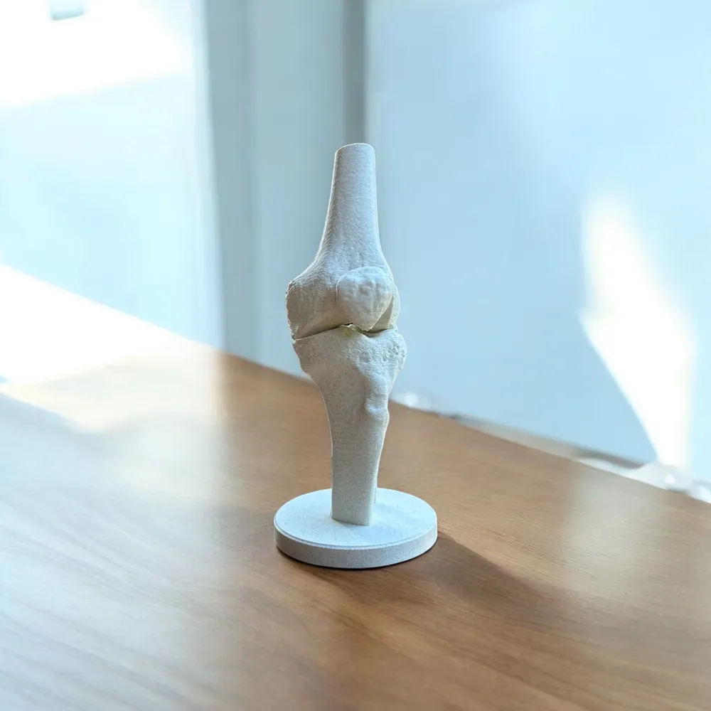 Anatomical Knee Model (from real CT) by TreeD-prints MakerWorld ...