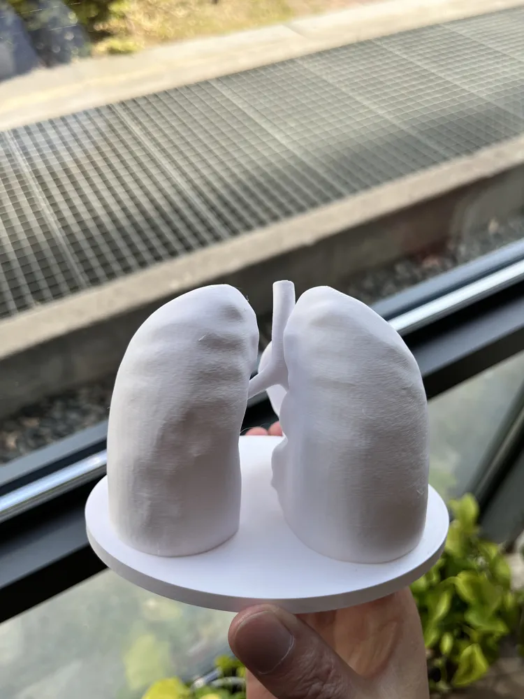 Pulmonary Medical Education Model by Zoom - MakerWorld