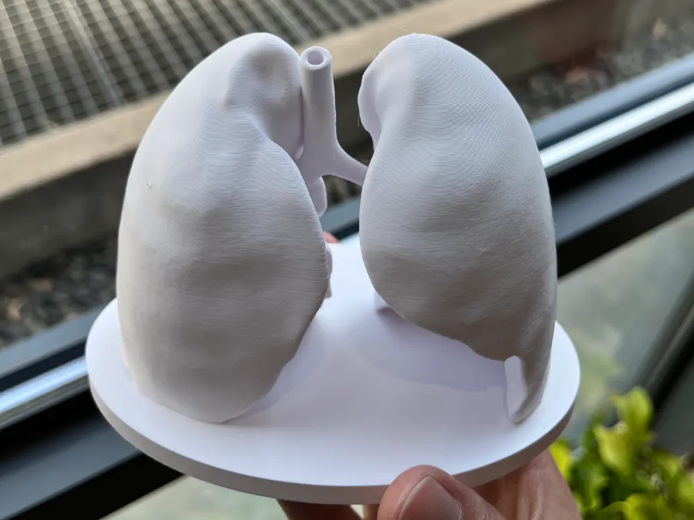 Pulmonary Medical Education Model by Zoom - MakerWorld