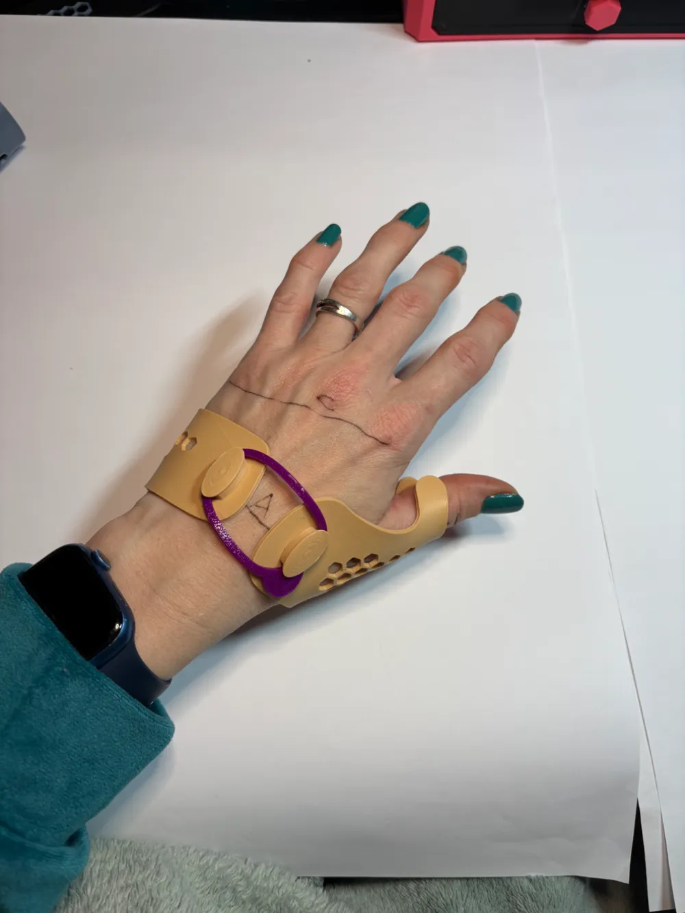 Right Thumb Brace CMC+MCP by familieKP MakerWorld: Download Free 3D Models