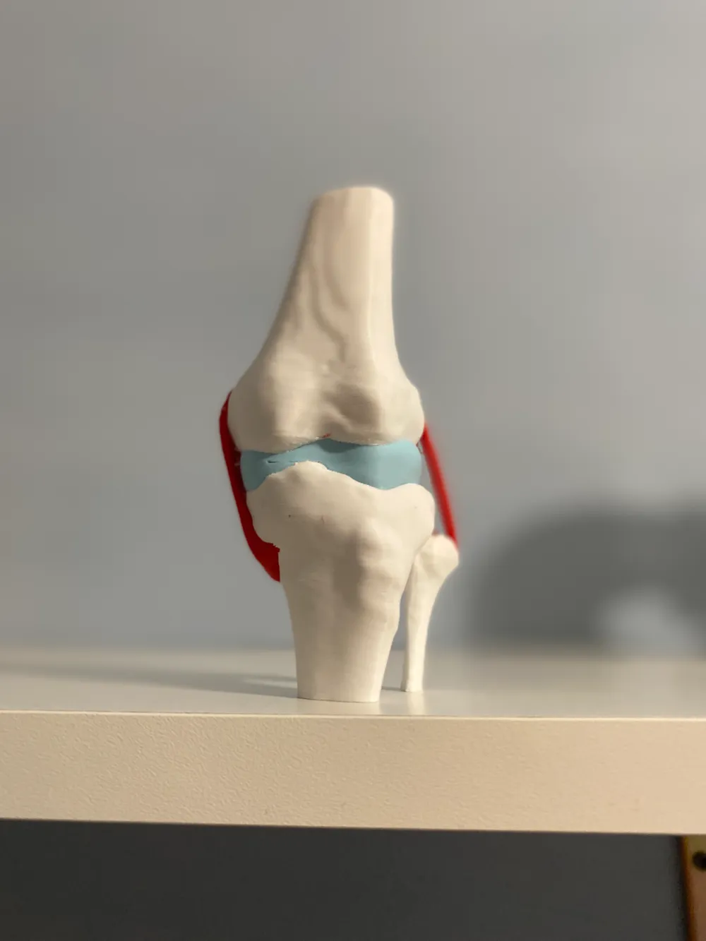 Knee with Meniscus and Collateral Ligaments by IceGabrielito MakerWorld ...