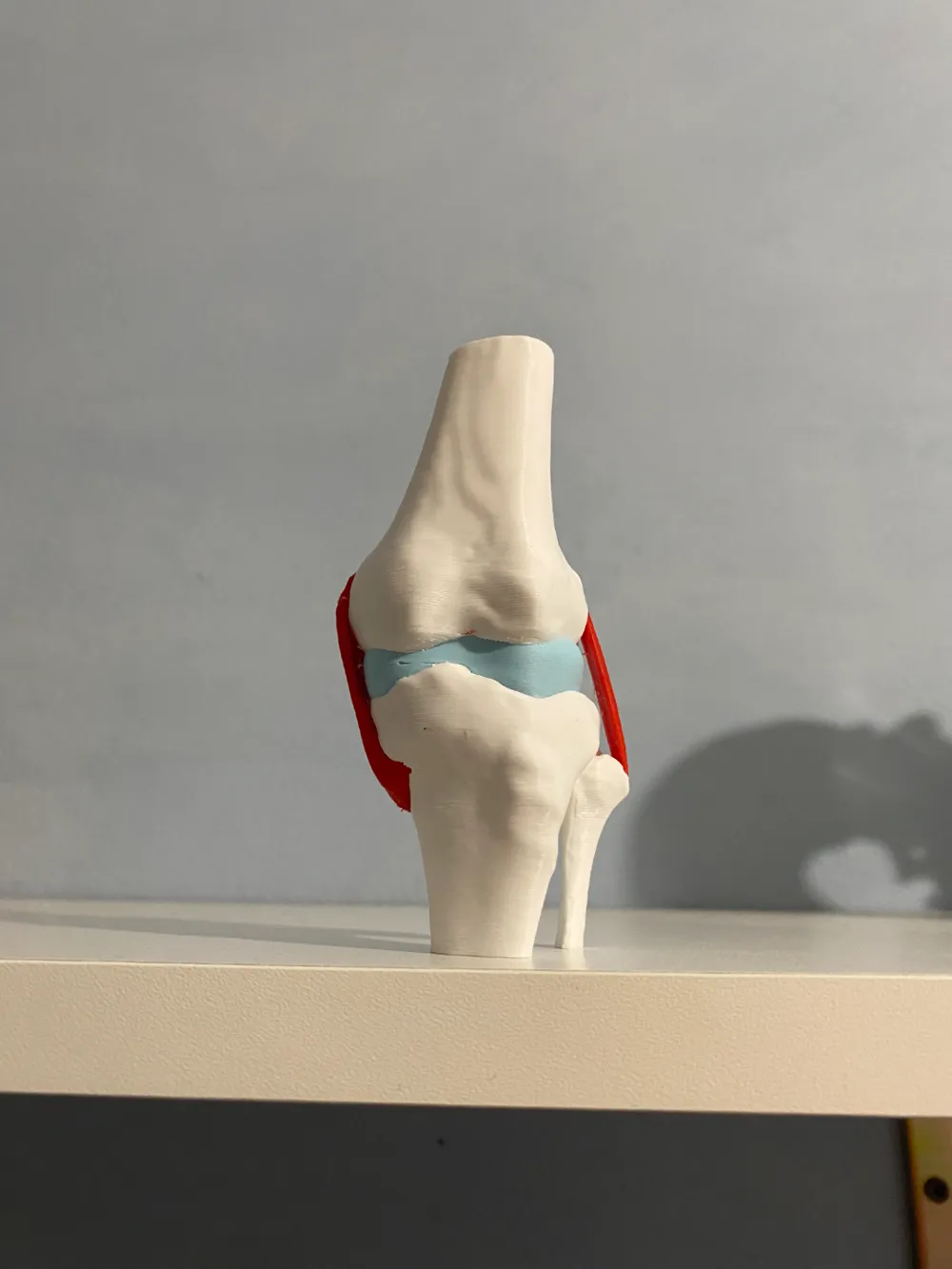 Knee with Meniscus and Collateral Ligaments by IceGabrielito MakerWorld ...