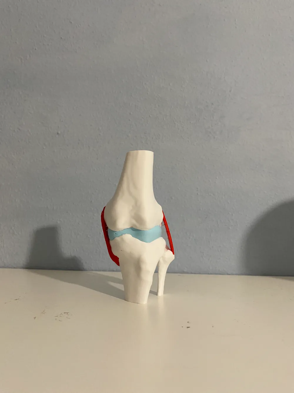 Knee with Meniscus and Collateral Ligaments by IceGabrielito MakerWorld ...