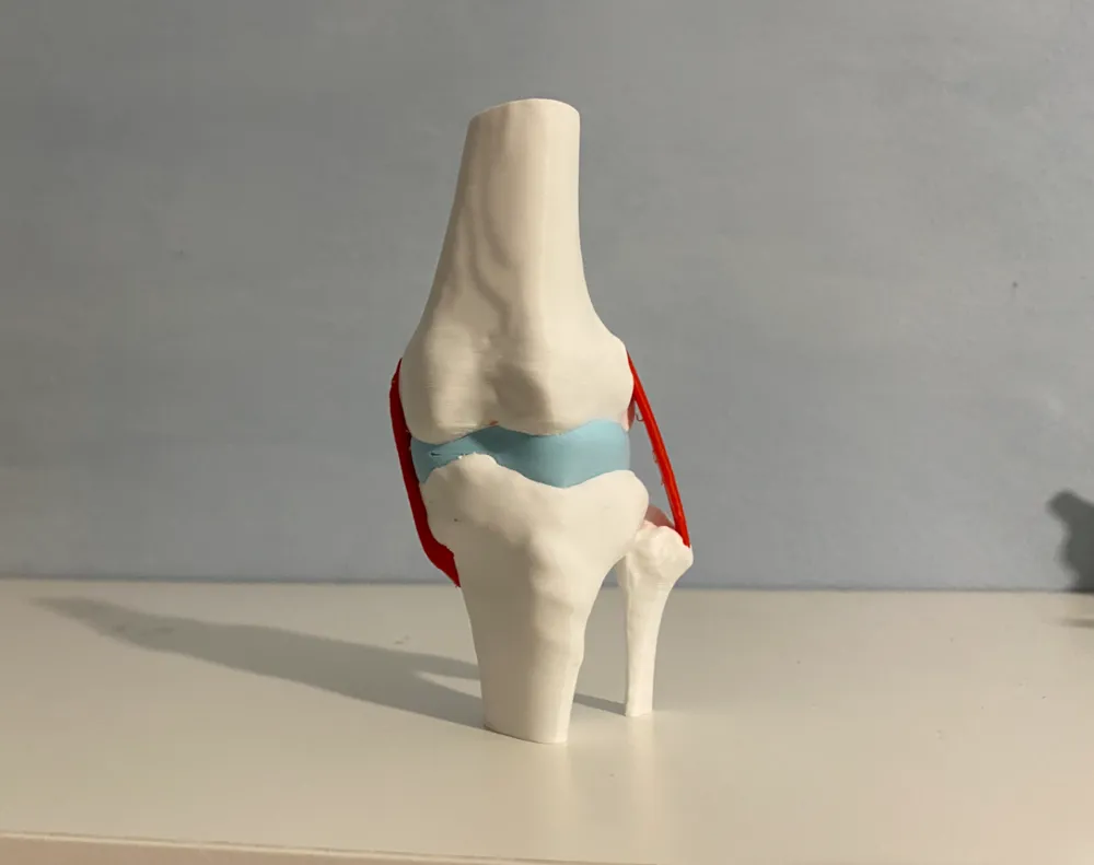 Knee with Meniscus and Collateral Ligaments by IceGabrielito MakerWorld ...