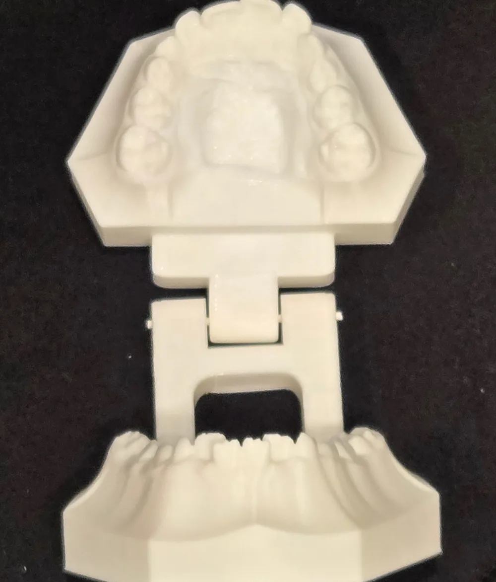 Pediatric Typodont-Mixed Dentition Class II, Div 2 - Free 3D Print ...