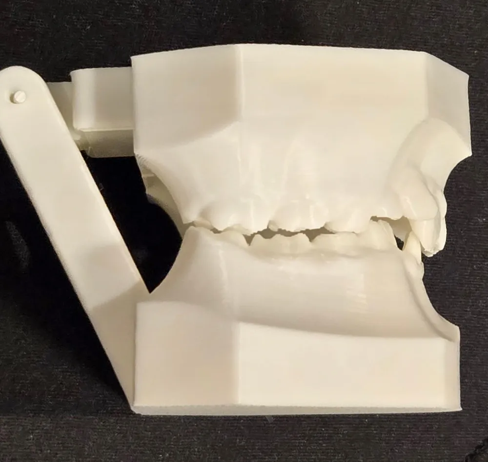 Pediatric Typodont-Mixed Dentition Class II, Div 2 - Free 3D Print ...