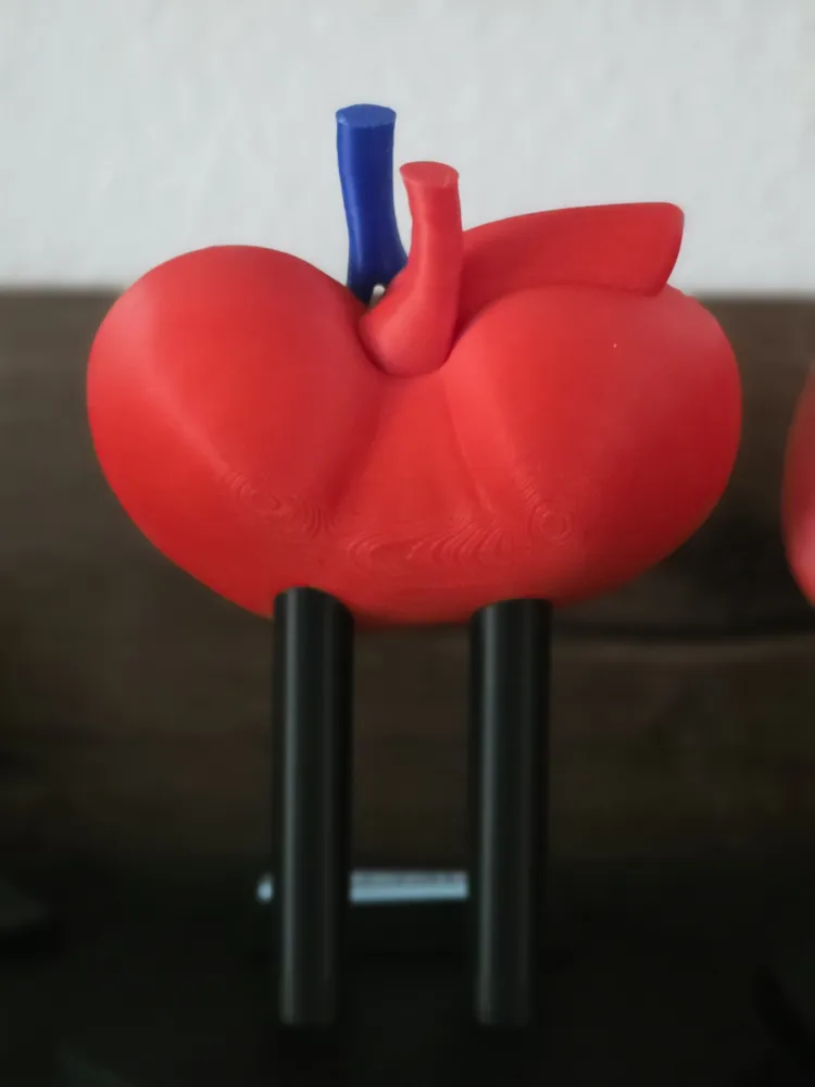 Human Kidney for Educational Purposes - Free 3D Print Model - MakerWorld