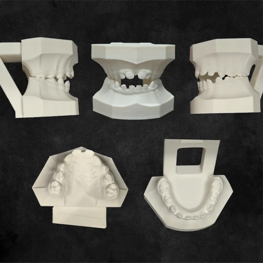 Primary Dentition Typodont - Open and Crossbite - Free 3D Print Model ...