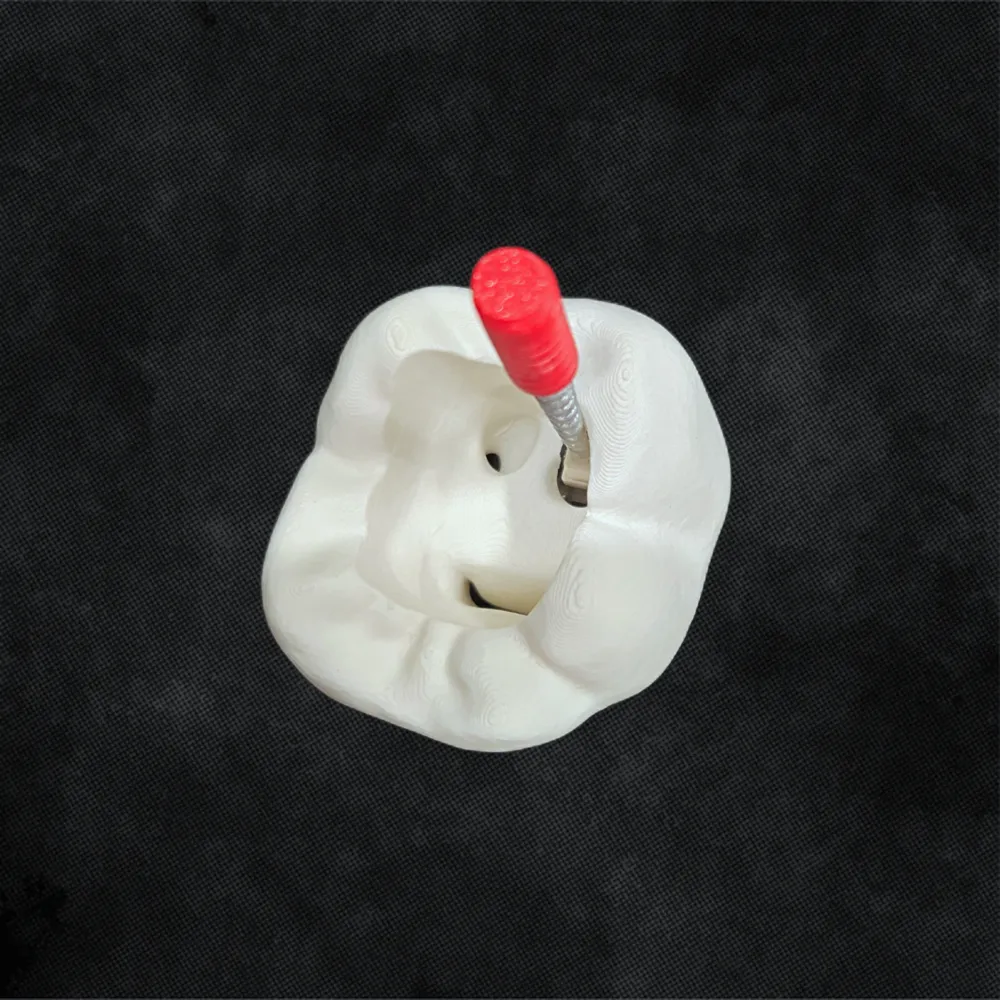 Root Canal Clicker - Endo Clicker by drshelby MakerWorld: Download Free ...