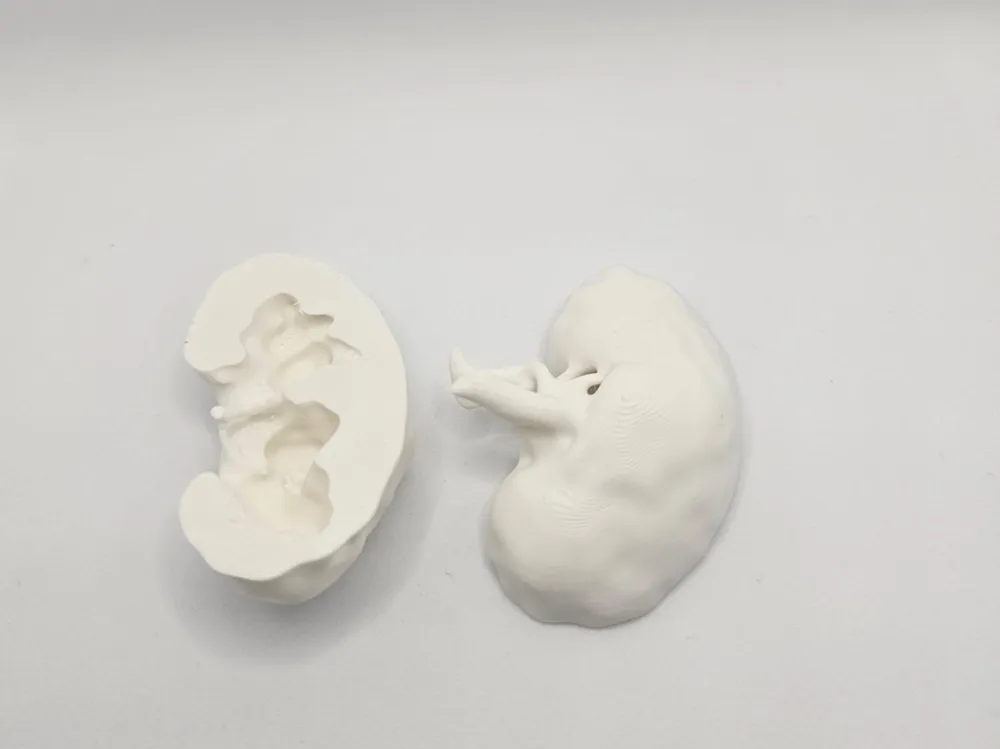 Left Kidney anatomical model (CT Scan) - Free 3D Print Model - MakerWorld