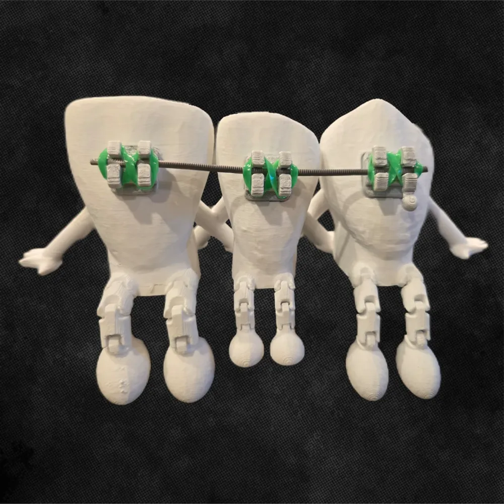 Toothie Buddy - Incisor lateral canine +/- braces by drshelby ...