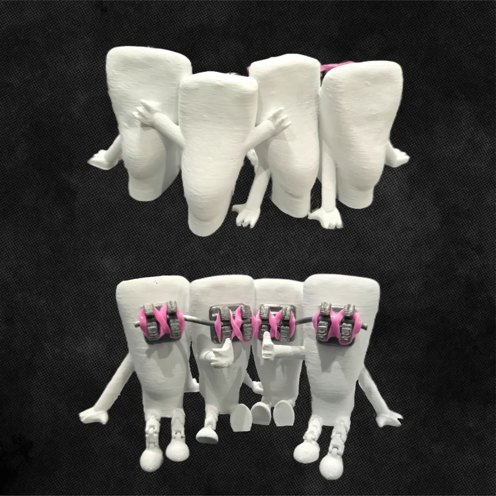 Crowded Lower Incisor Tooth Buddy with Braces - Free 3D Print Model ...