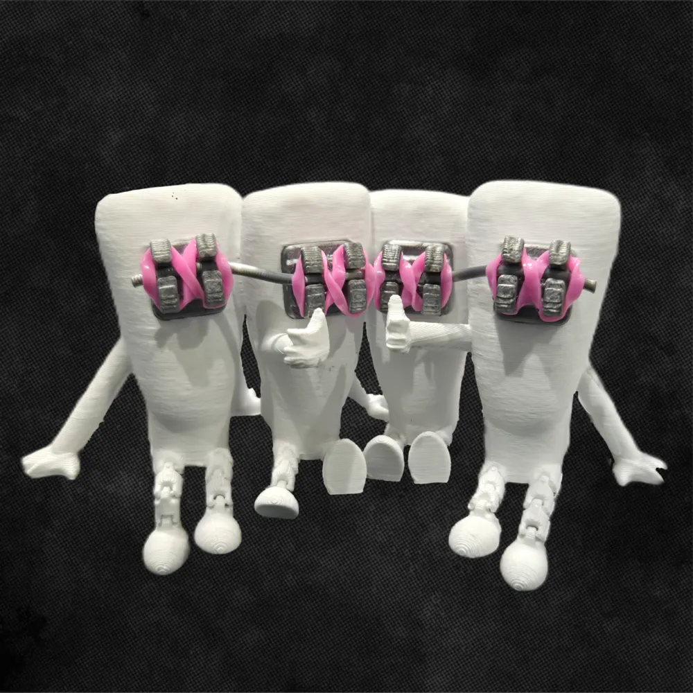 Crowded Lower Incisor Tooth Buddy with Braces - Free 3D Print Model ...
