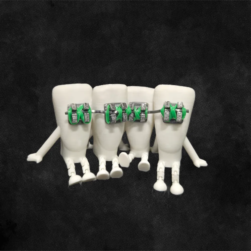 Crowded Lower Incisor Tooth Buddy with Braces - Free 3D Print Model ...