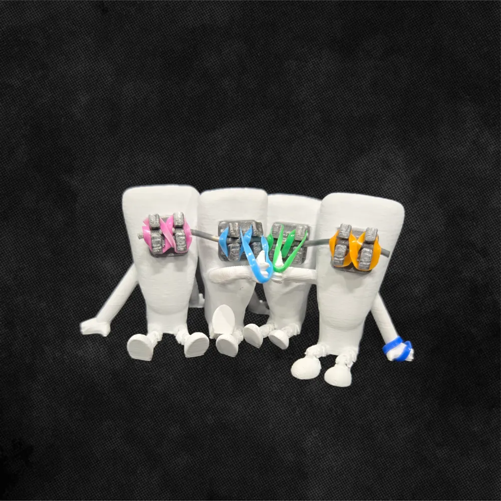 Crowded Lower Incisor Tooth Buddy with Braces - Free 3D Print Model ...