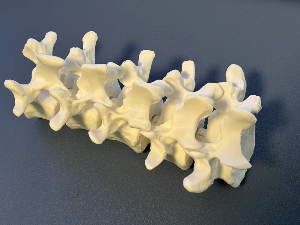 Articulating Lumbar Vertebrae Spine - Free 3D Print Model - MakerWorld
