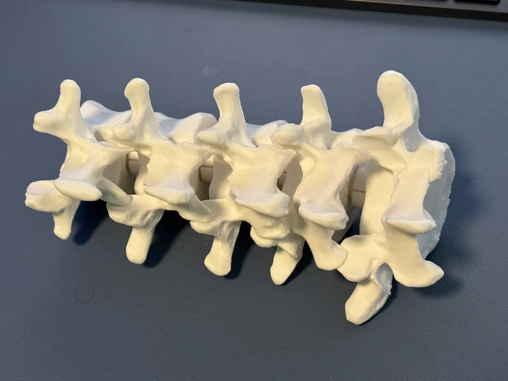 Articulating Lumbar Vertebrae Spine Remixed by GSam85 MakerWorld ...