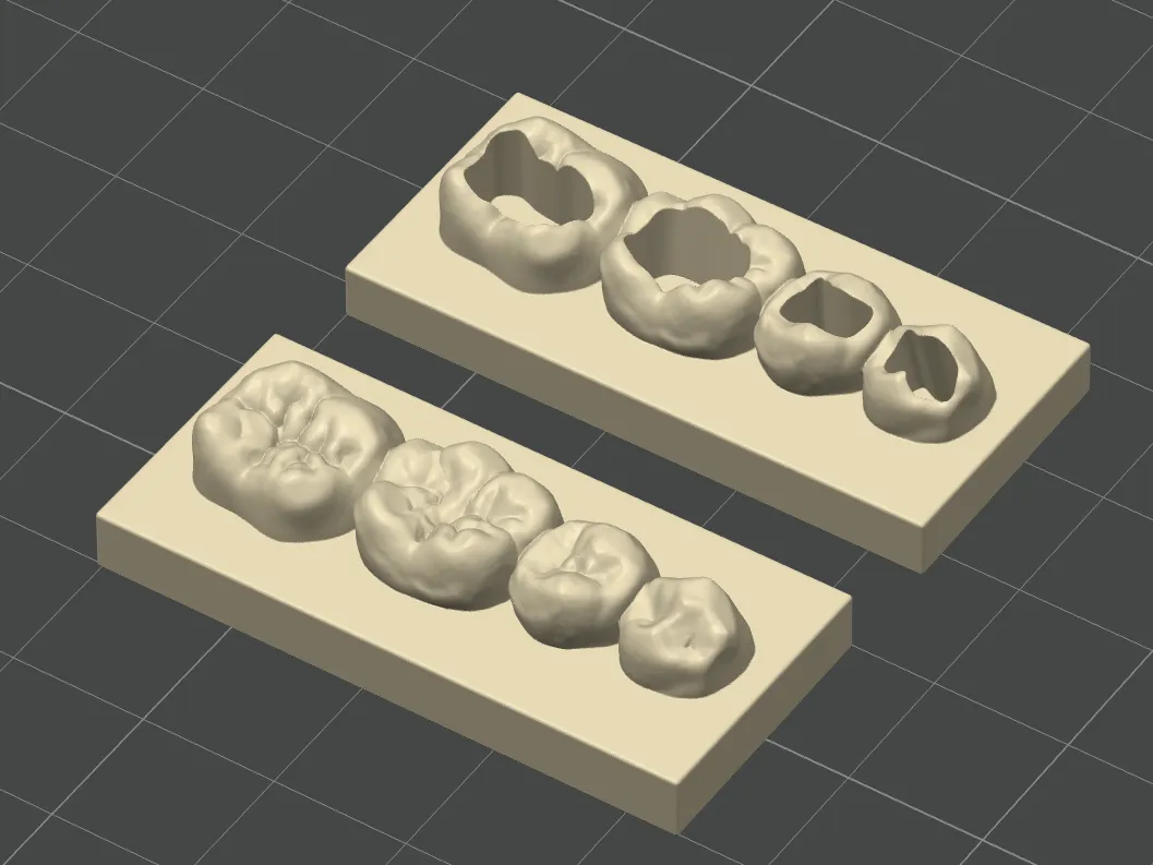 Dental model for restorative course - Free 3D Print Model - MakerWorld