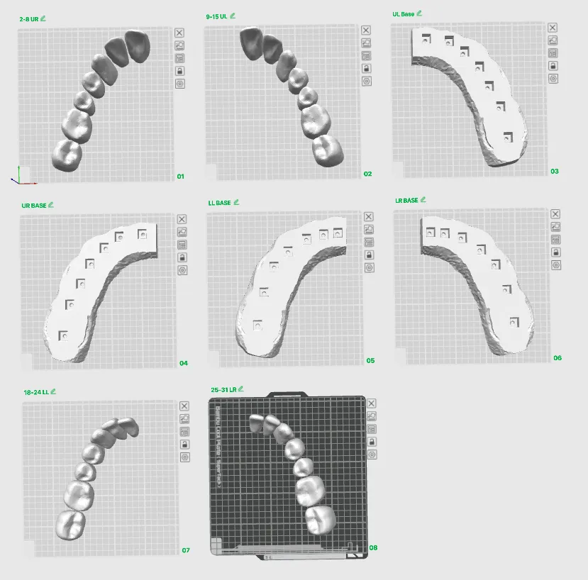 Full Mouth Teeth Clickers by The Doro Dojo MakerWorld: Download Free 3D ...