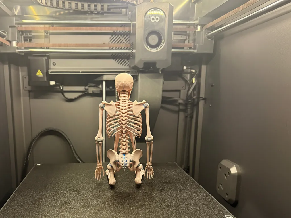 Sad Depressed Skeleton - Free 3D Print Model - MakerWorld
