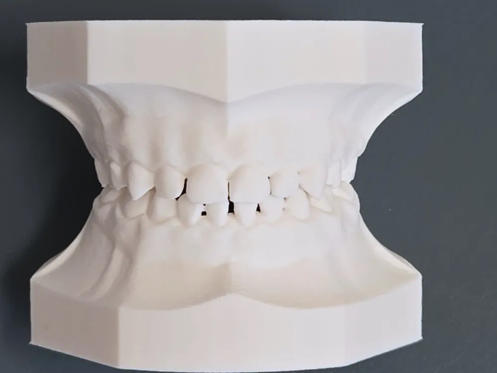 Primary Dentition Typodont – Class I Ideal - Free 3D Print Model ...