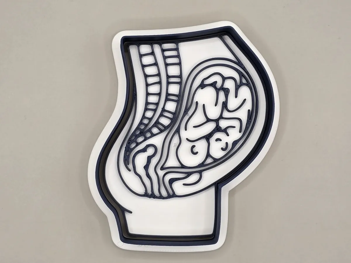 Twin Pregnancy Anatomy Womb Woman Cutter Stamp - Free 3D Print Model ...