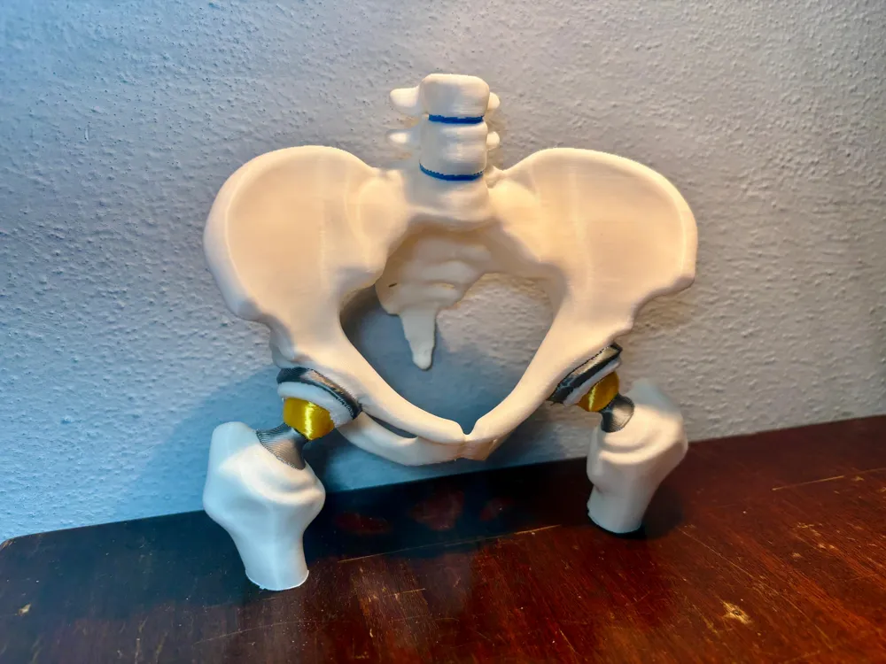 Bilateral Hip Prosthesis - Free 3D Print Model - MakerWorld