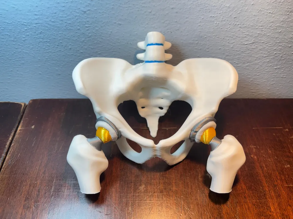 Bilateral Hip Prosthesis - Free 3D Print Model - MakerWorld