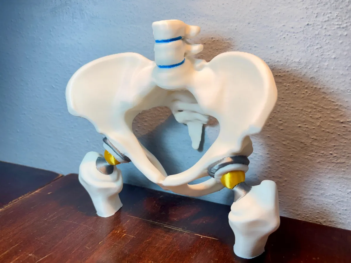 Bilateral Hip Prosthesis - Free 3D Print Model - MakerWorld
