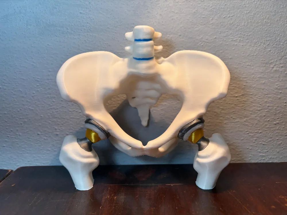 Bilateral Hip Prosthesis - Free 3D Print Model - MakerWorld