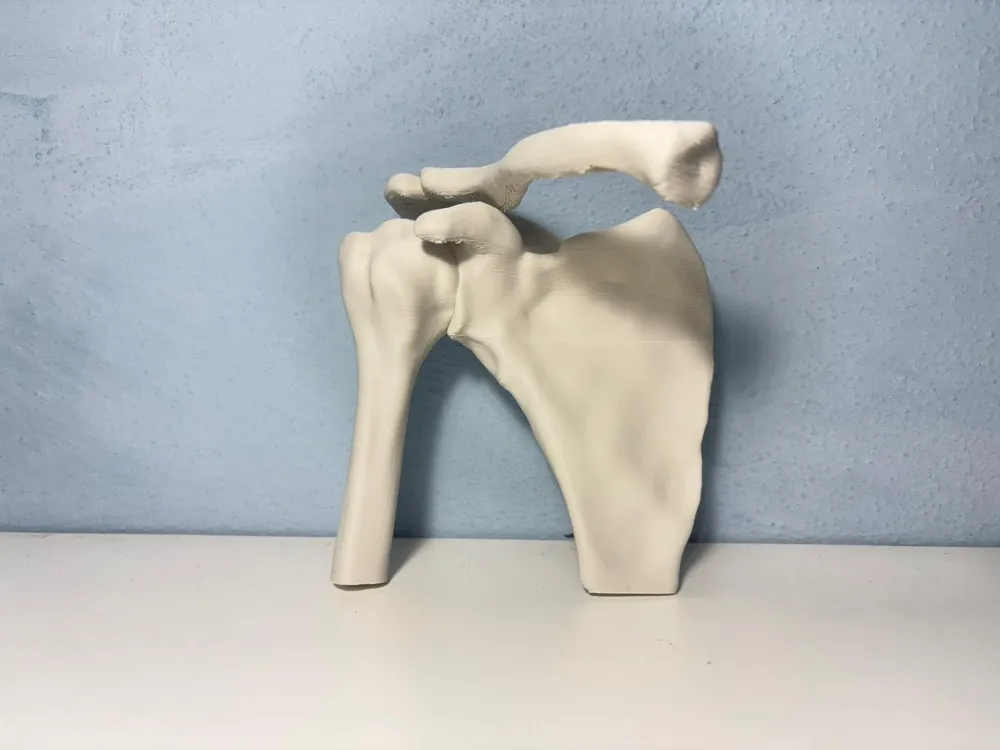 3Dプリント 肩の解剖学（CTスキャンから） - 無料3Dモデル -MakerWorld