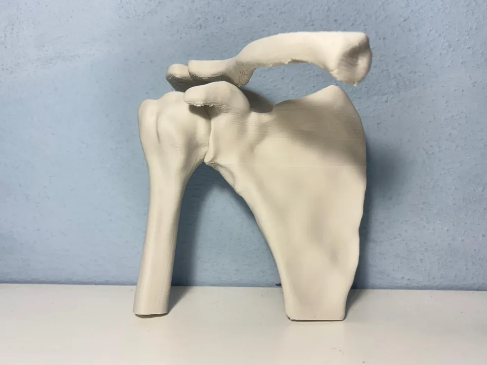 Shoulder anatomy (from CT SCAN) - Free 3D Print Model - MakerWorld